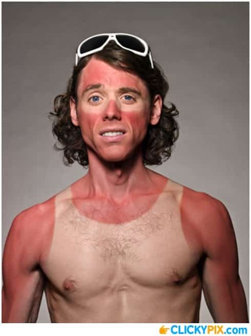 Is a Healthy Tan, Healthy? – Dr. Andrew Ting